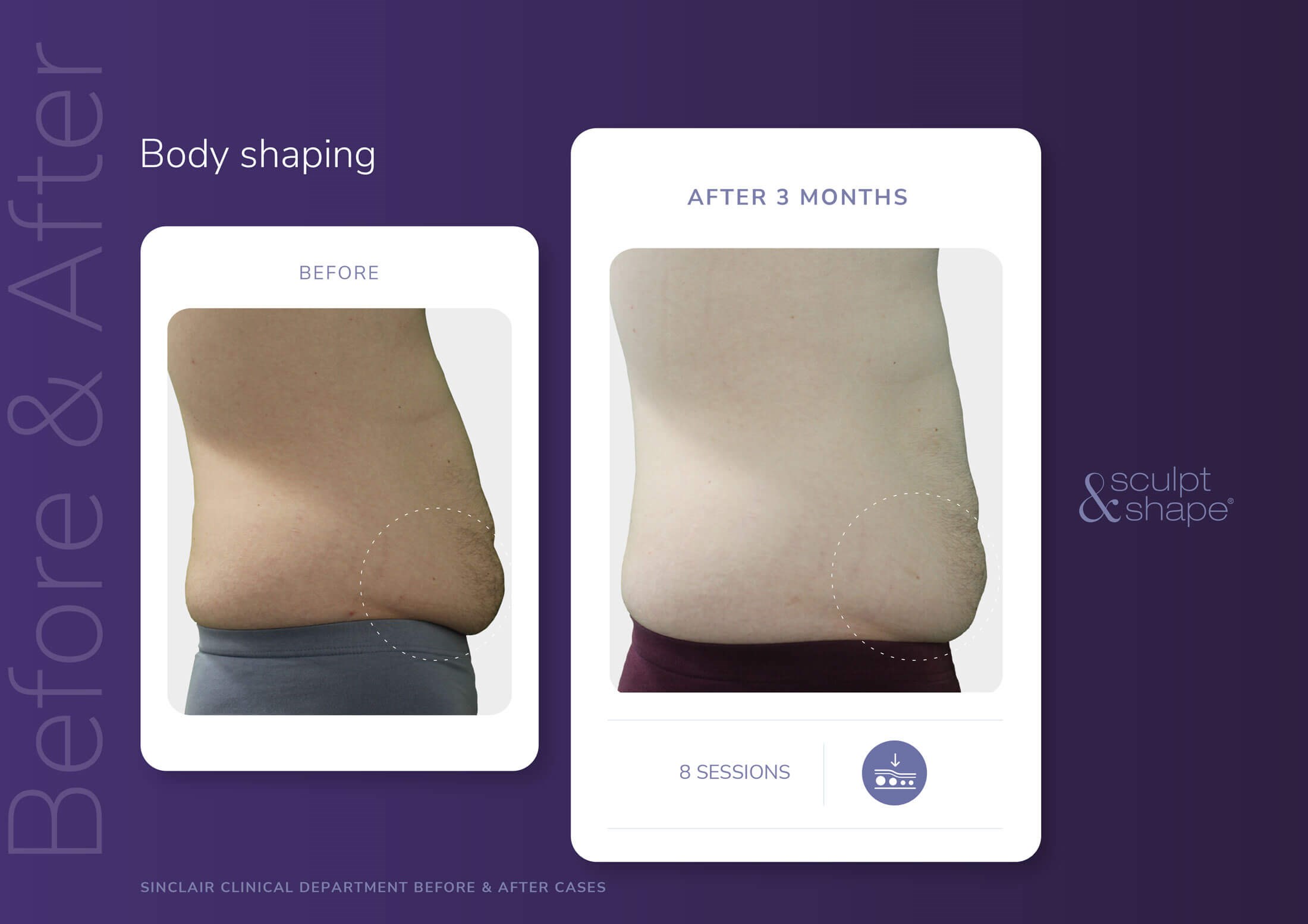 The PMFA Journal: How I Do It - Full body contouring - Sinclair United Kingdom